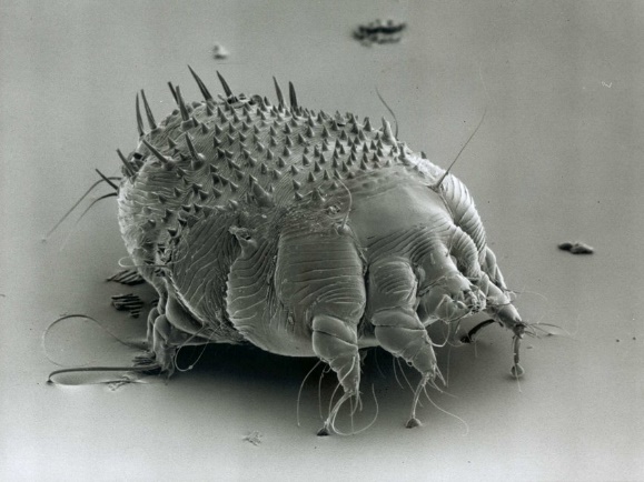 Skabies: Si Tungau Pembuat Gatal – Sekilas Indonesia